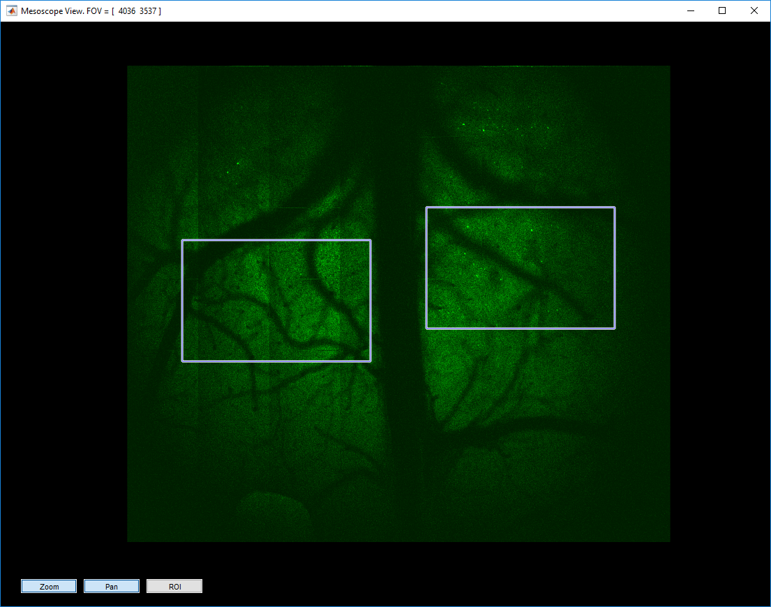 Mesoscope features: real-time panoramas, ROI selection, zoom/pan, and ...
